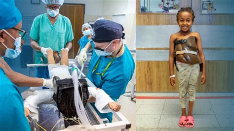 Betselots Story Her Deformity Does Not Define Her Identity Tim Tebow Foundation