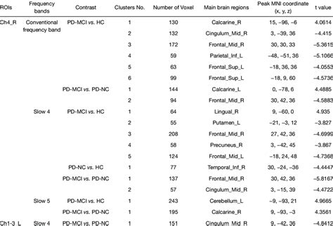 Brain Regions Showing Significant Functional Connectivity Differences