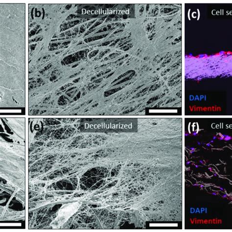 Electrodes In Extracellular Matrix Ecm Modification By Human Dermal