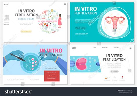 Flat Vitro Fertilization Websites Set Pregnant Stock Vector Royalty