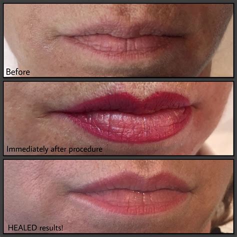 Permanent Makeup Lips Before After
