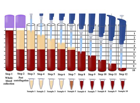 Bio PRF Science BioPRF EU