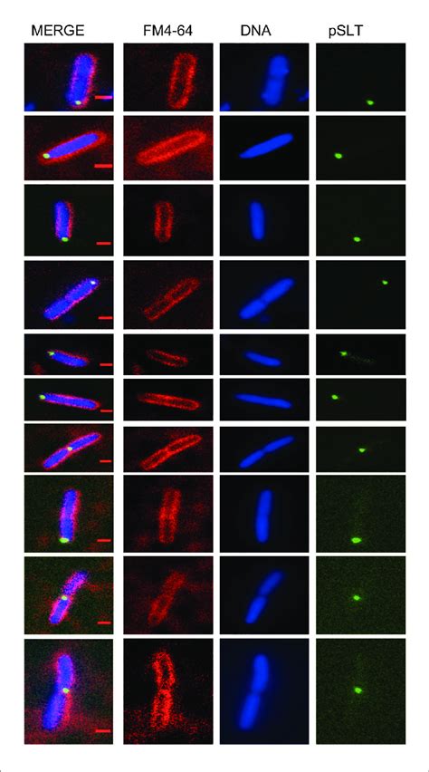 Subcellular Localization Of The Salmonella Virulence Plasmid In A