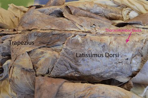 Latissimus Dorsi Cadaver