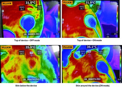 The Digital Infrared Thermal Imaging Analysis Download Scientific Diagram