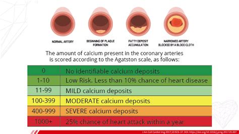 Calcium Modification Techniques In Complex Pci Pdf Heart And