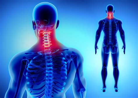 Guidelines For Investigating C Spine Injuries Pedmore Medical