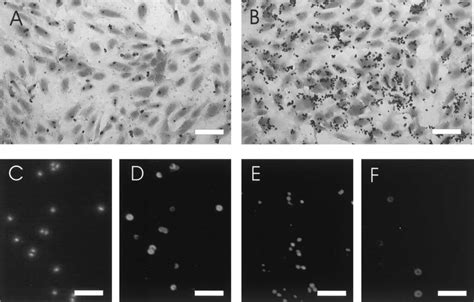 Microscopic Evaluation Of Staphylococcal Adherence And Capsule