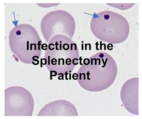 Emergency Medicine Educationdangers Of Infection In The