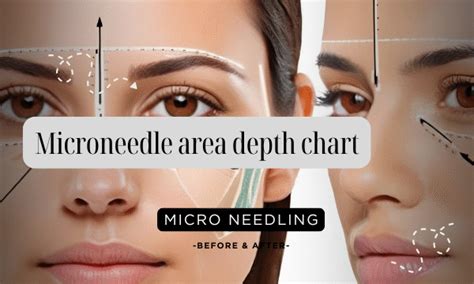 How To Microneedle Scalp