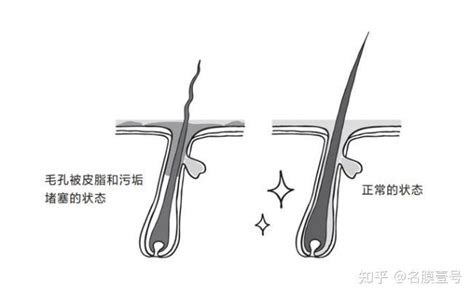 MECMOR名膜壹号黑金面膜排浊嫩肤效果也太惊艳了吧 知乎