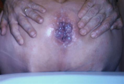 Jadore Les Aiguilles à Lintérieur Des Testicules Photos Porno Photos Xxx Images Sexe 873542
