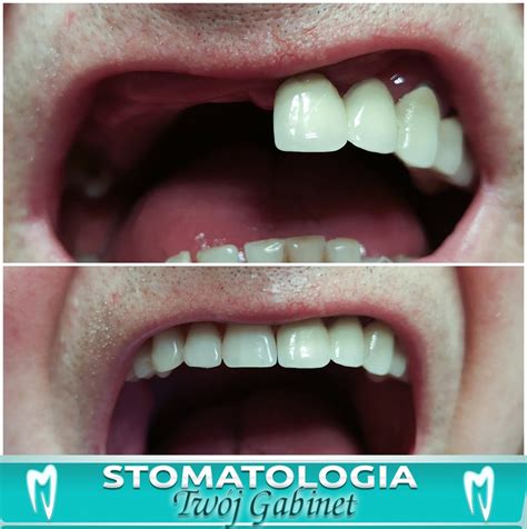 Twój Gabinet Bydgoszcz Gabinet i Pracownia Protetyki Dentysta Protetyk