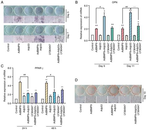 Role Of P53 In Promoting BMP9induced Osteogenic Differentiation Of