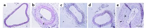Intimal Lesion Formation Was Suppressed In Mk Deficient Mice And