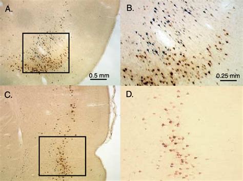 Photomicrographs Of Retrograde Labeling Produced In The Insular Cortex