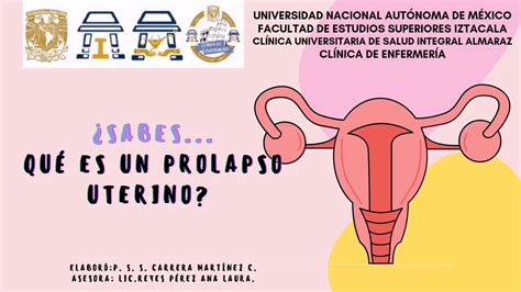 👀¿sabés Que Es Un Prolapso Uterino 👀 🔸un Prolapso Uterino Ocurre
