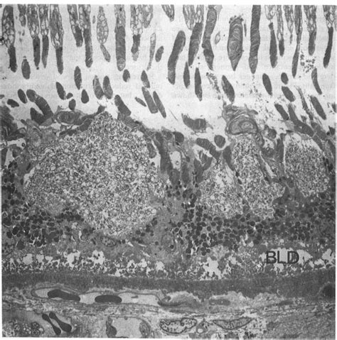 Electron Micrograph Of An Area Shown In Fig 17 The Photoreceptor Outer Download Scientific