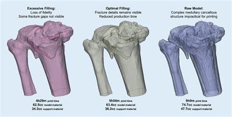 9 Fracture Model Fabrication Requires A Balance Between Preserving