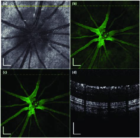 Vis Oct And Fa Images Simultaneously Acquired From A Rat Retina In