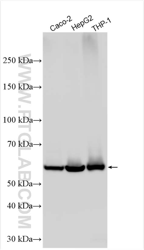 Ces1 Antibody 29041 1 Ap Proteintech