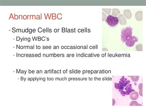 Hematology Basics Pt 2