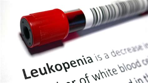 Leukopenia Low White Cell Count Causes Symptoms And Treatment