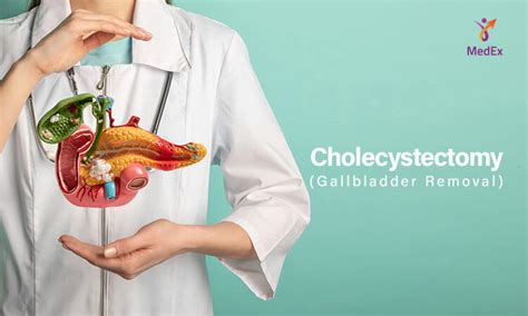 Cholecystectomy Gallbladder Removal Medex
