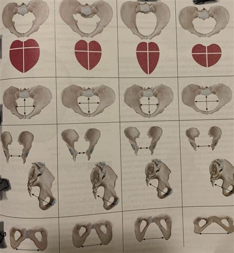 Four Basic Pelvis Types Diagram Quizlet