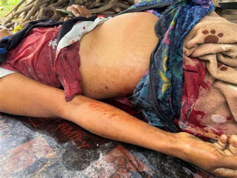 သင်္ကြန်အတက်နေ့တွင် စစ်ကောင်စီက ကော့ကရိတ်မြို့၊ မြောက်ကမ္မရိုက်ရွာကို Y 12 လေယာဥ်ဖြင့် ဗုံးကျဲ