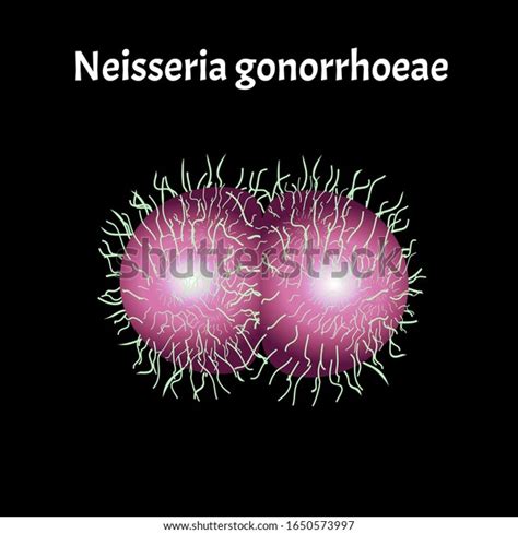 Gonococcus Structure Neisseria Gonorrhoeae Gonorrhea Disease เวกเตอร์