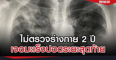 ชายวัย 70 ปี เจอ มะเร็งปอด ระยะสุดท้าย หลังไม่ได้ตรวจร่างกายนาน 2 ปี คมชัดลึก