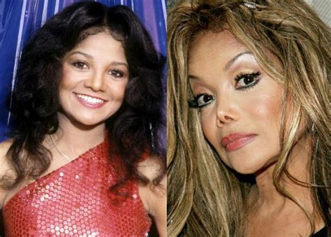 Extraordinary And Extreme Plastic Surgery Before And After Photo Session