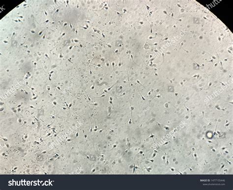 Sperm Cell Under Electron Microscope