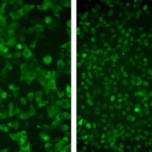 Stable Cell Lines Innoprot Recombinant In Vitro Models