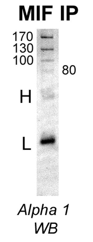 Co Immunoprecipitation Of Mif A1 I3 From Bladder Homogenates