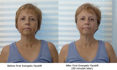 Access Bars® Adelaide Gawler Barossa