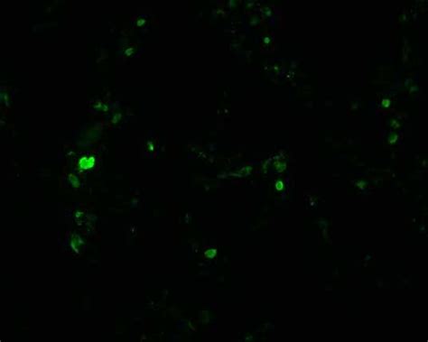 Human Baffblystnfsf13b Cdna Clones Hg10056 Sino Biological