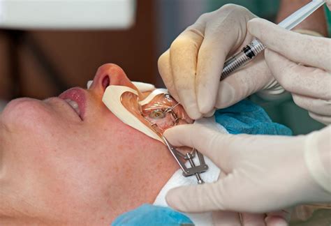 6 Penyebab Selulitis Orbita Infeksi Pada Orbit Mata