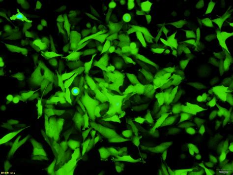 慢病毒、腺相关病毒包装价格低至2500元，快至2周发货 赛业生物