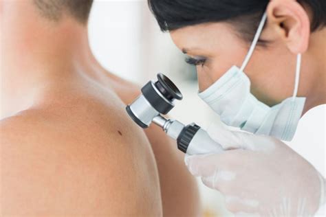 Experts Unsure If Full Body Skin Cancer Screening Saves Lives