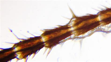 Why Roaches Are Extremely Hard To Catch Uhandy Microscope Medium