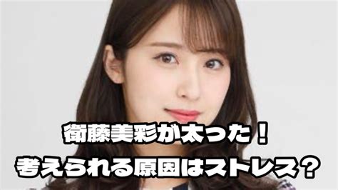 衛藤美彩が太って顔が変わった理由は？｜出産や夫の不倫でストレスか