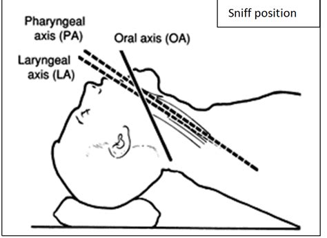 Intubation Protocol