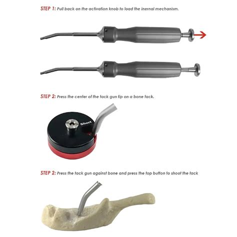Mctbio Auto Bonetac Gun And Mini Tack Set Tbm 05
