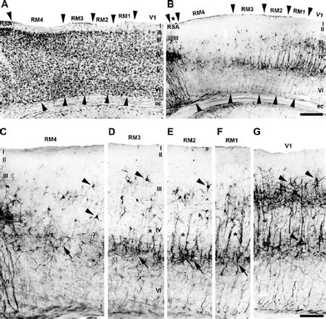 Illustration Of The Laminar Architecture Of The Rm Extrastriate Cortex