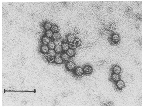 Electron Micrograph Of Chicken Parvovirus Like Particles Purified In