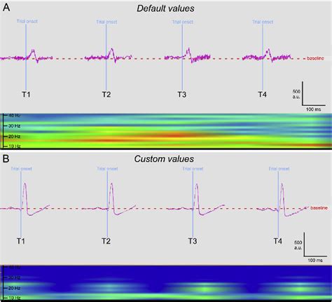 Figure 2 From Adjustment Of The Data Acquisition Window For The