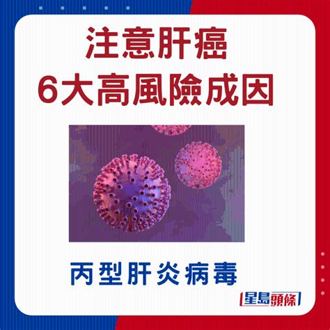 港男有 三高”腰背痛揭患晚期肝癌，2症状易忽略，6因素易致癌 星岛环球网