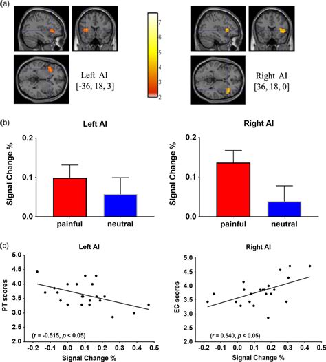 Association Between The Activity Of The Ai And Trait Empathy A The Download Scientific